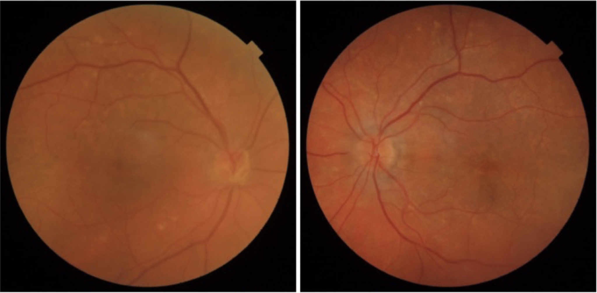 EURETINA – European Society of Retina Specialists